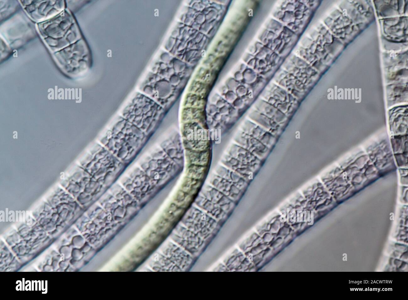 Light micrograph of cyanobacteria filaments, Planktothrix rubescens and ...