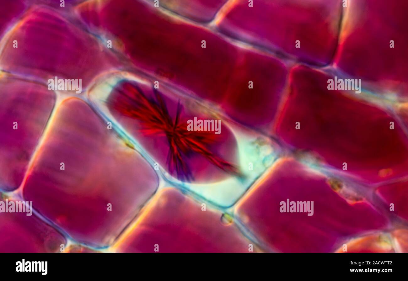 Light micrograph of the upper epidermis of Paprika (Capsicum annuum ...