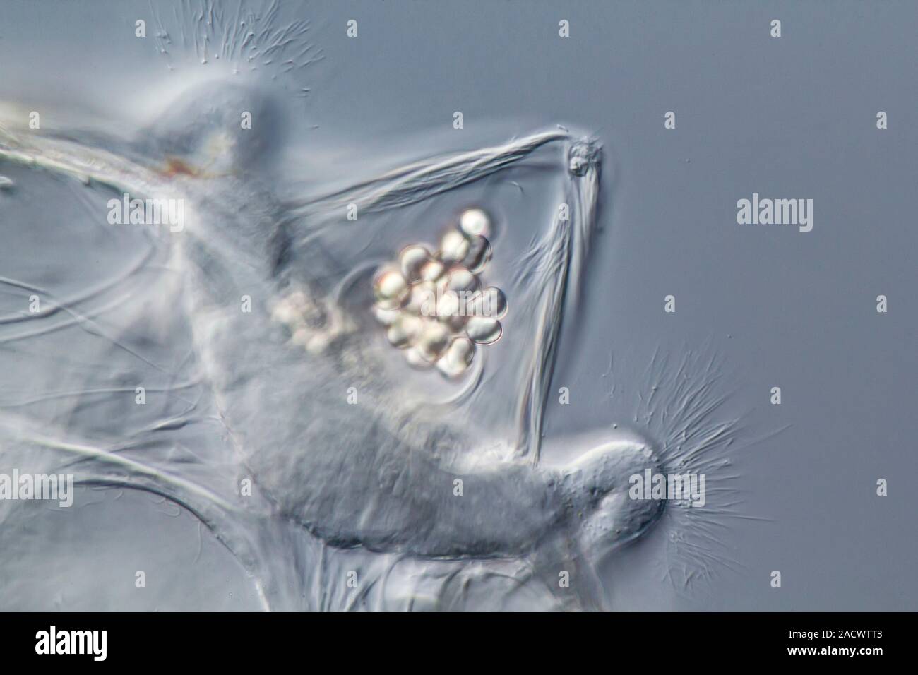 Light micrograph of a small species of sea gooseberry (Pleurobrachia sp ...