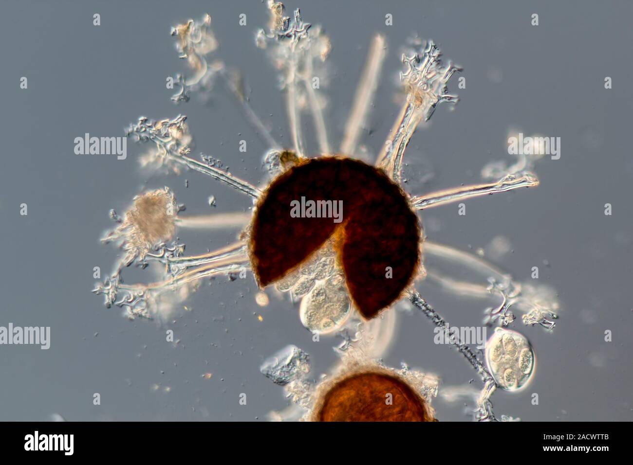 Light micrograph of a cleistothecium of Microsphaera alphitoides ...