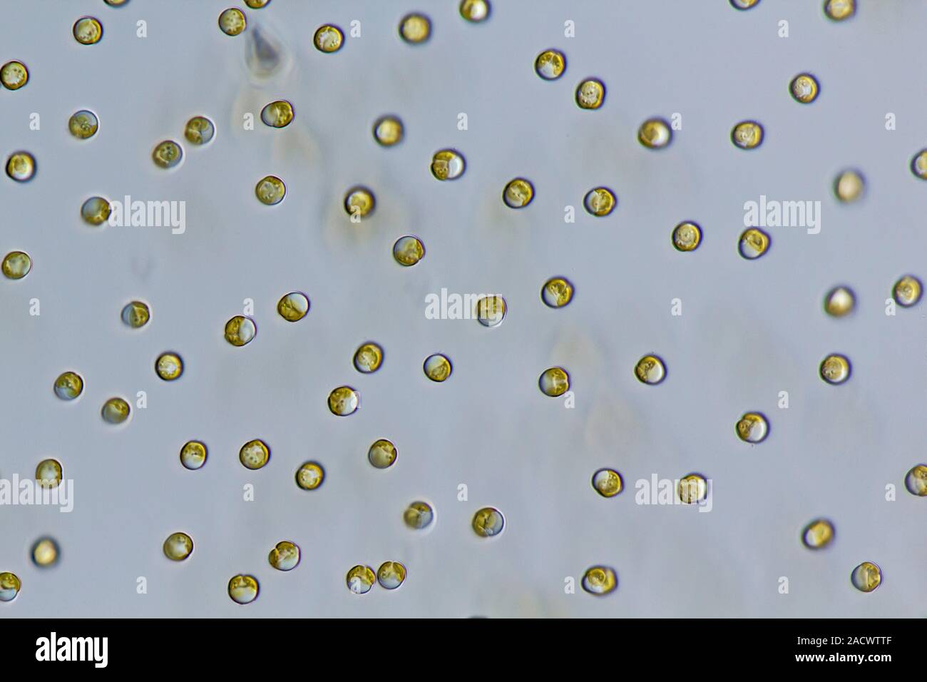 Light micrograph of a Phaeocystis alga colony detail. These marine ...