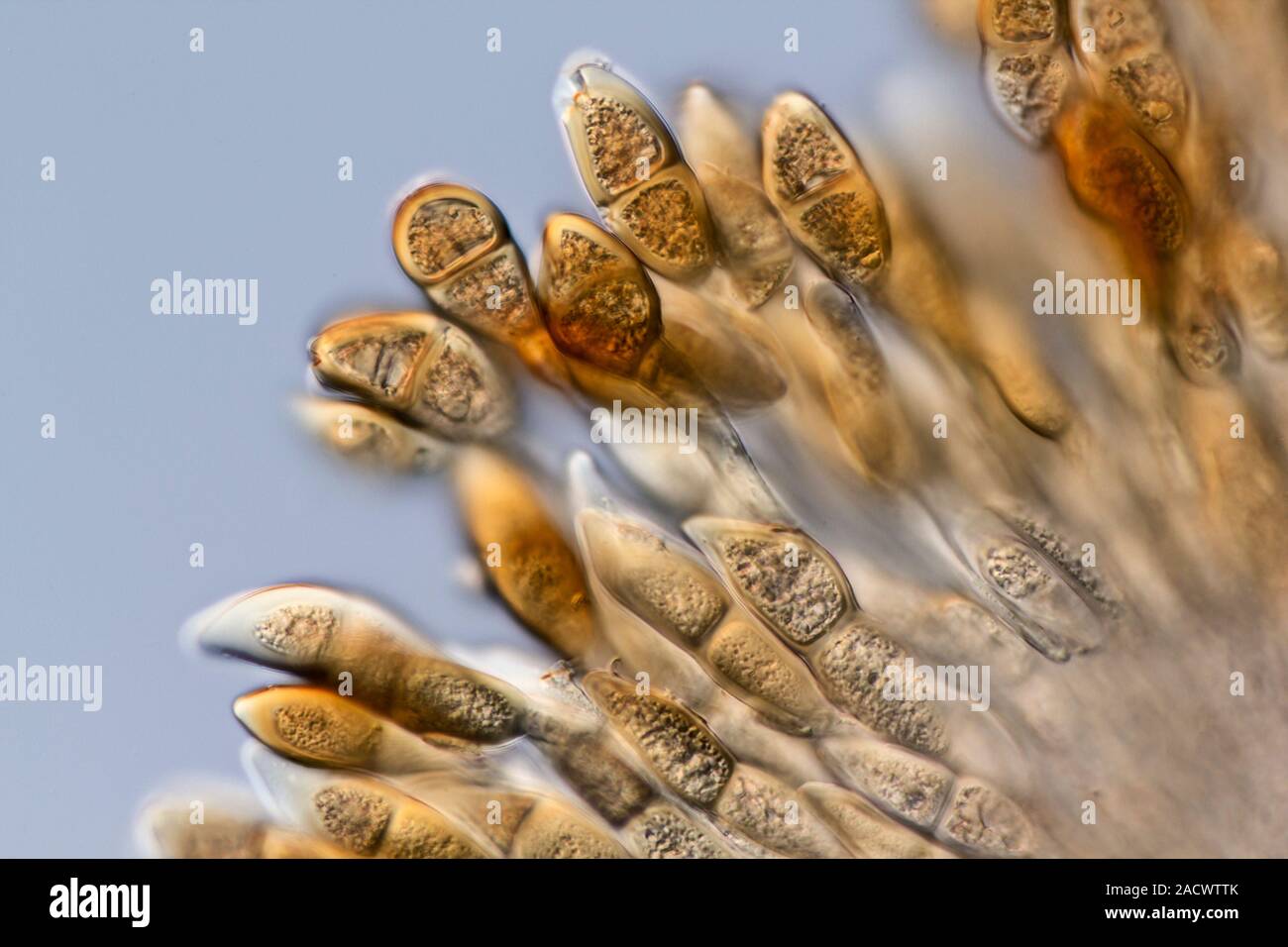 Light micrograph of Teliospores of Hollyhock rust, Puccinia malvacearum ...