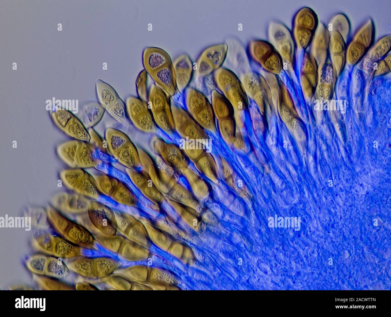 Light micrograph of Teliospores of Hollyhock rust, Puccinia malvacearum ...