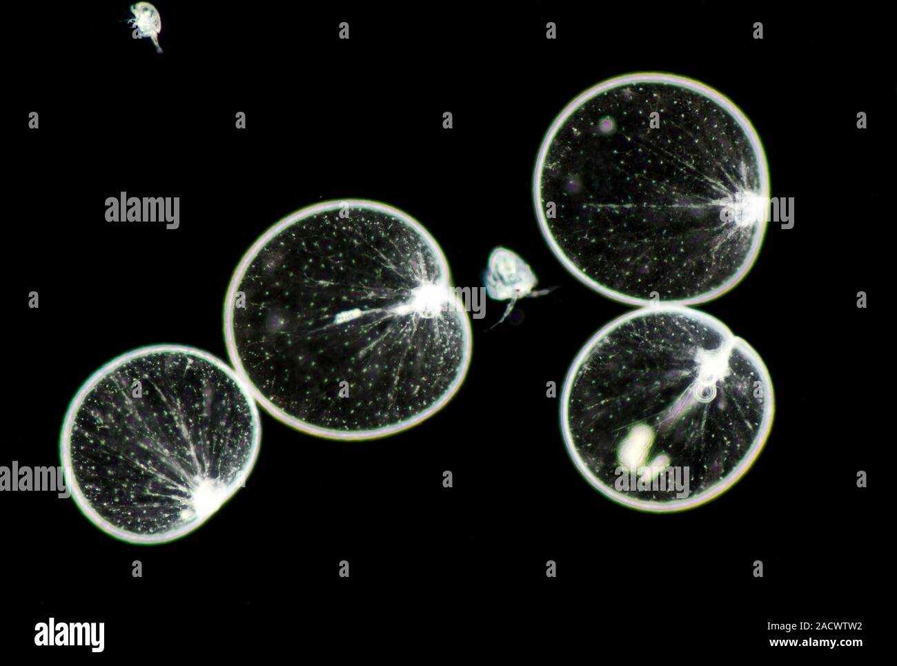 Light micrograph of Noctiluca scintillans, a large bladder-shaped ...
