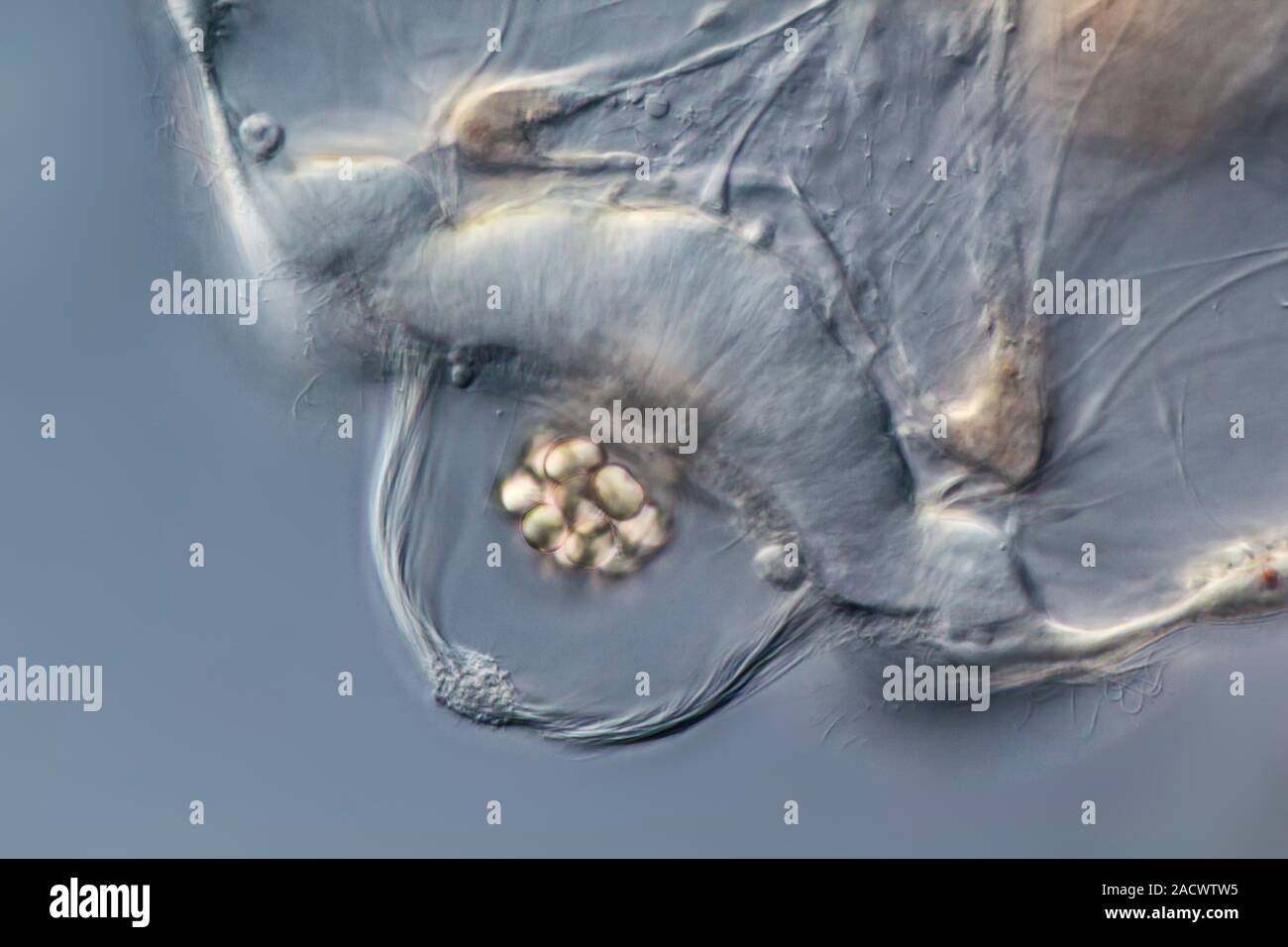 Light micrograph of a small species of sea gooseberry (Pleurobrachia sp ...
