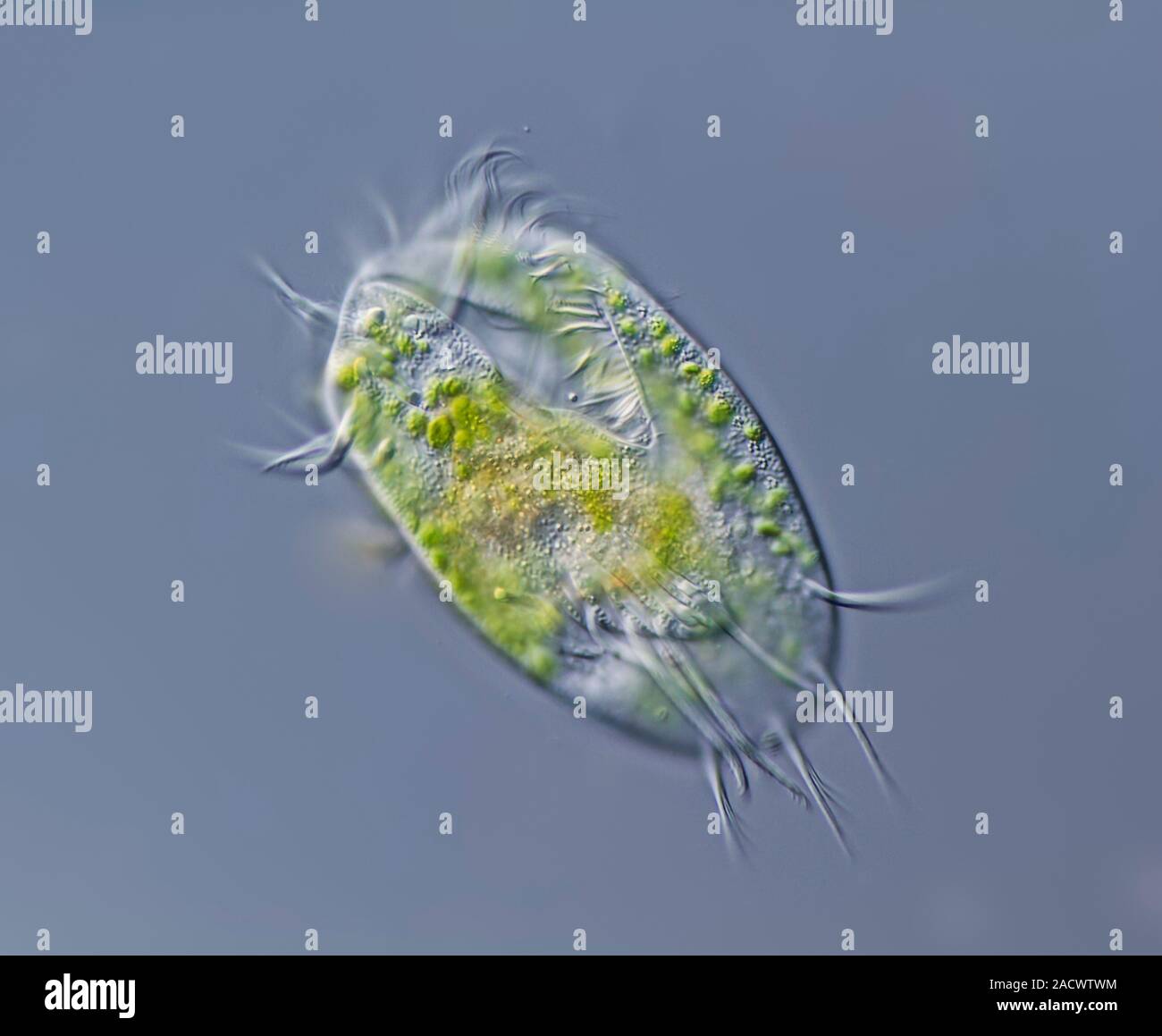 Light micrograph of Euplotes sp., a freswater Hypotrich Ciliate ...