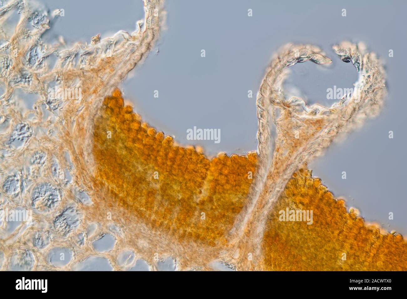 Light micrograph of fungal rust aecidium of Puccinia lagenophorae on ...
