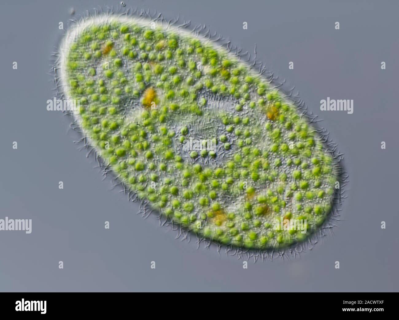 Light micrograph of living cells of Paramecium bursaria, a common ...