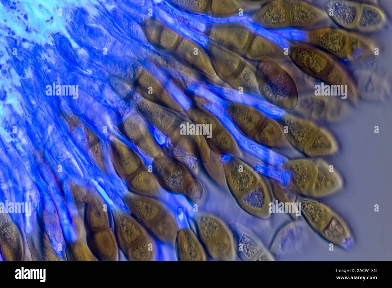 Light micrograph of Teliospores of Hollyhock rust, Puccinia malvacearum ...