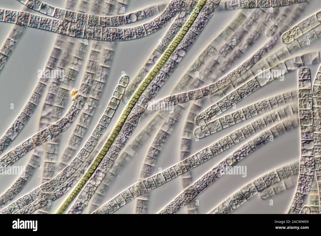 Light micrograph of cyanobacteria filaments, Planktothrix rubescens and ...