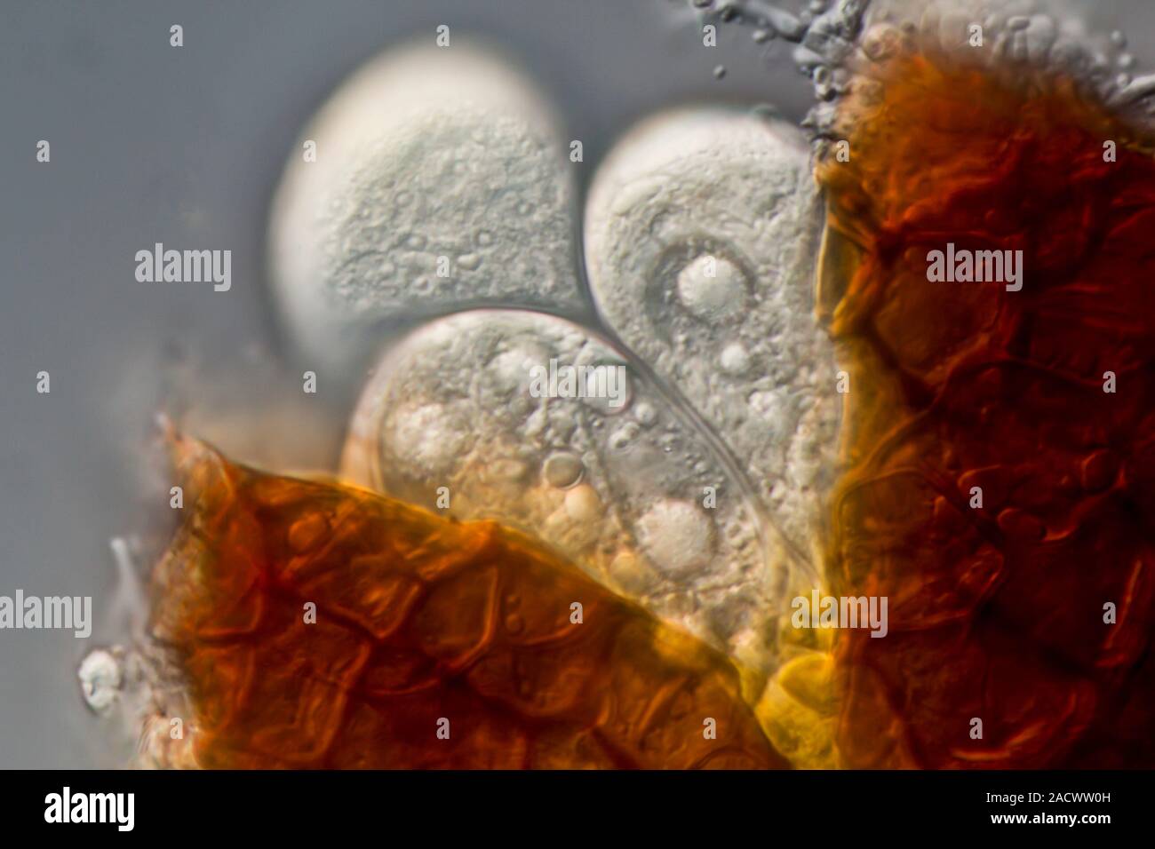 Light micrograph of a cleistothecium of Microsphaera alphitoides ...