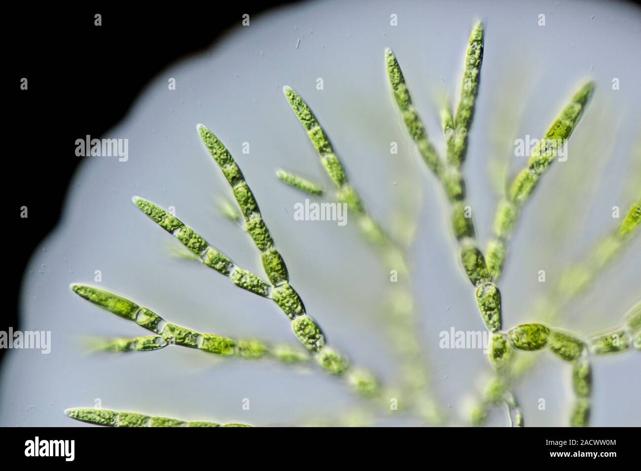 Light micrograph of Chaetophora green alga, prepared with indian ink to ...