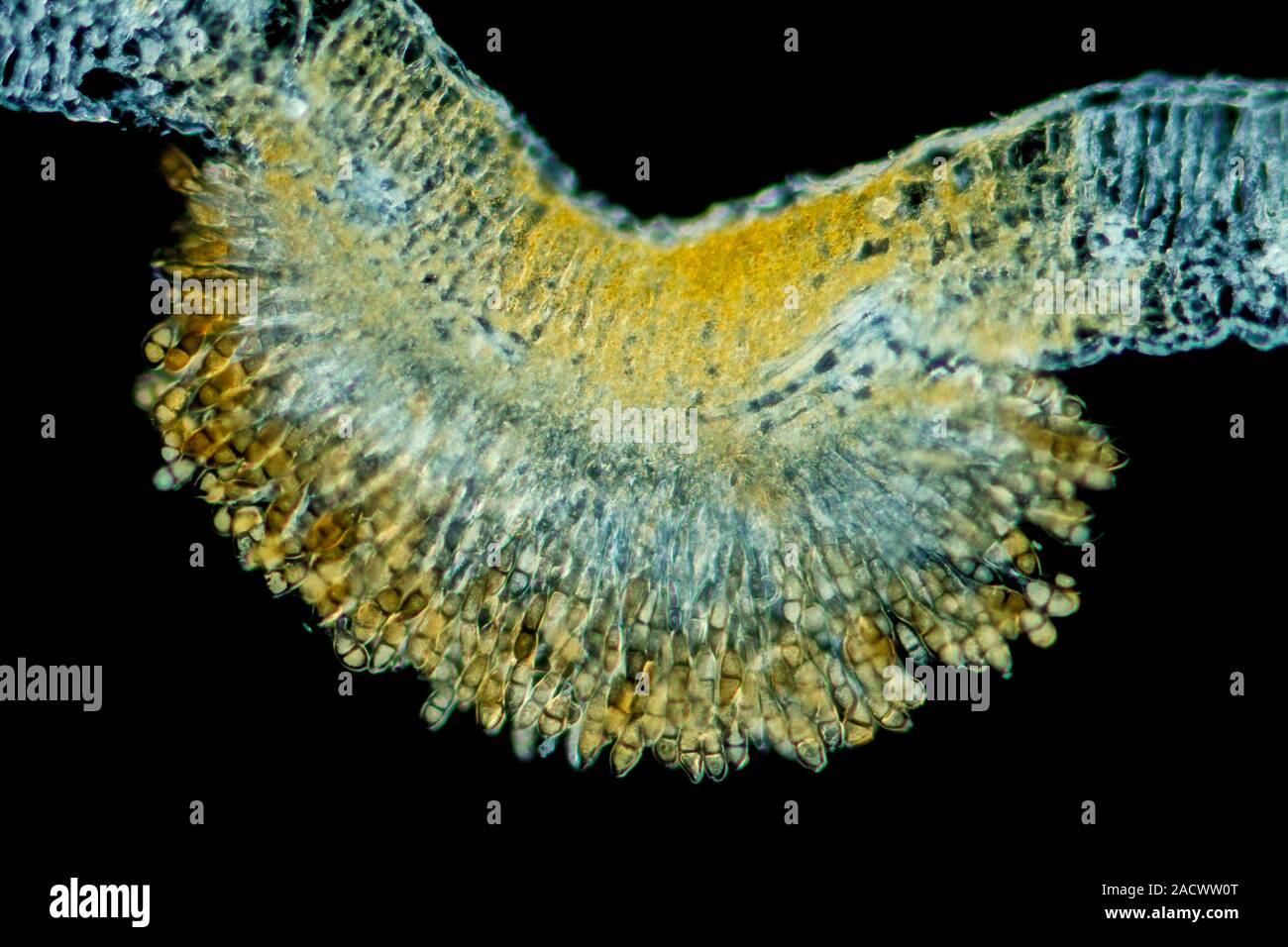 Light micrograph of Teliospores of Hollyhock rust, Puccinia malvacearum ...