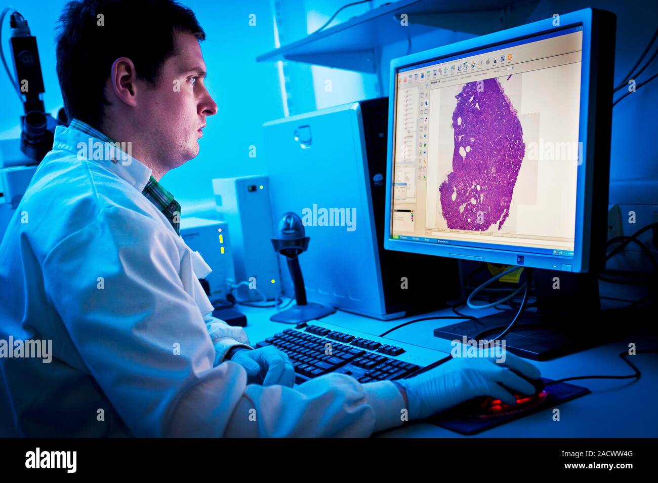 Histopathology. Researcher examining a microscope view of a tissue ...