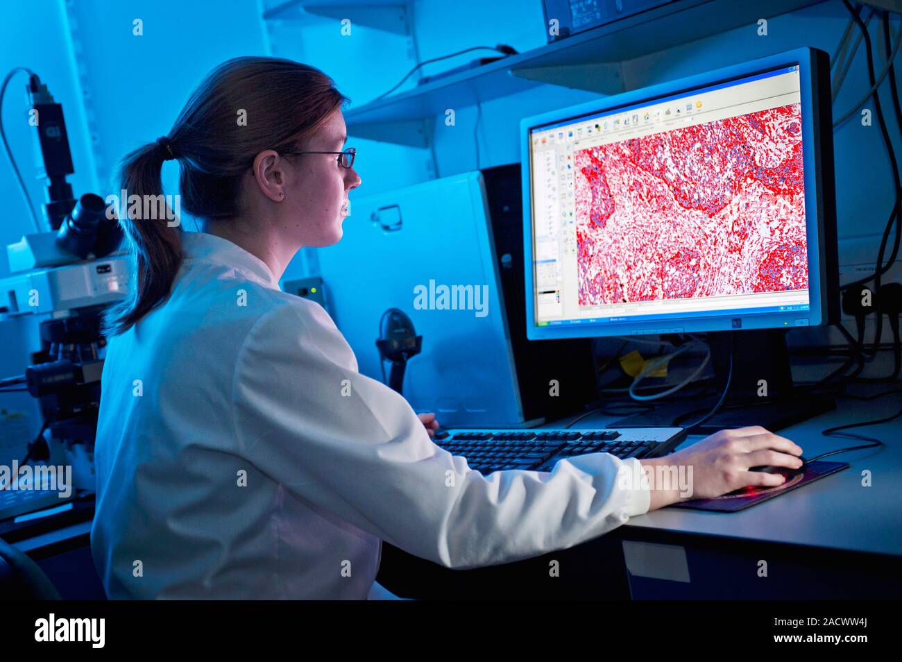 Histopathology. Researcher examining a microscope view of a tissue ...