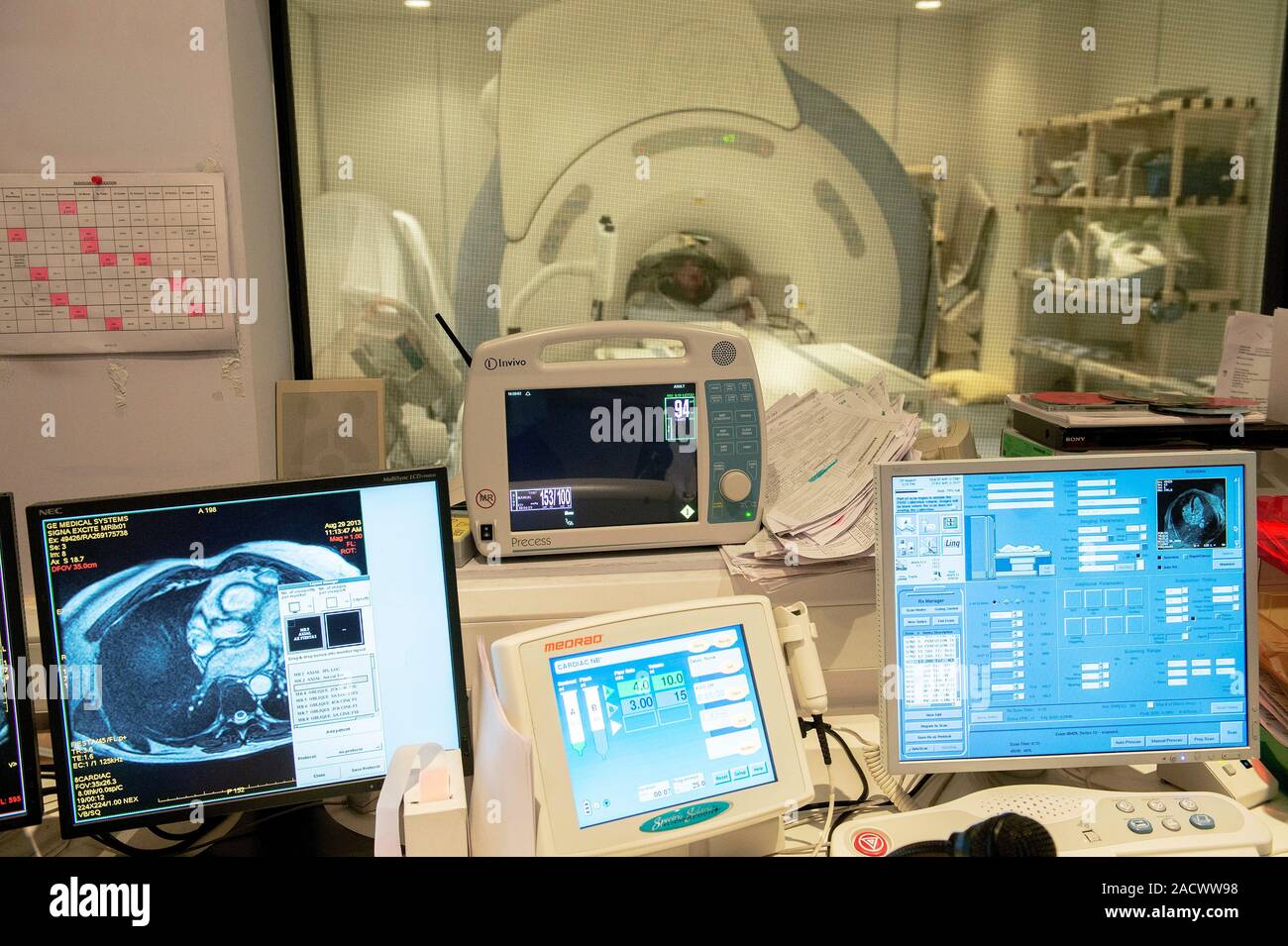 Cardiac MRI scanning. Display screens and magnetic resonance imaging ...