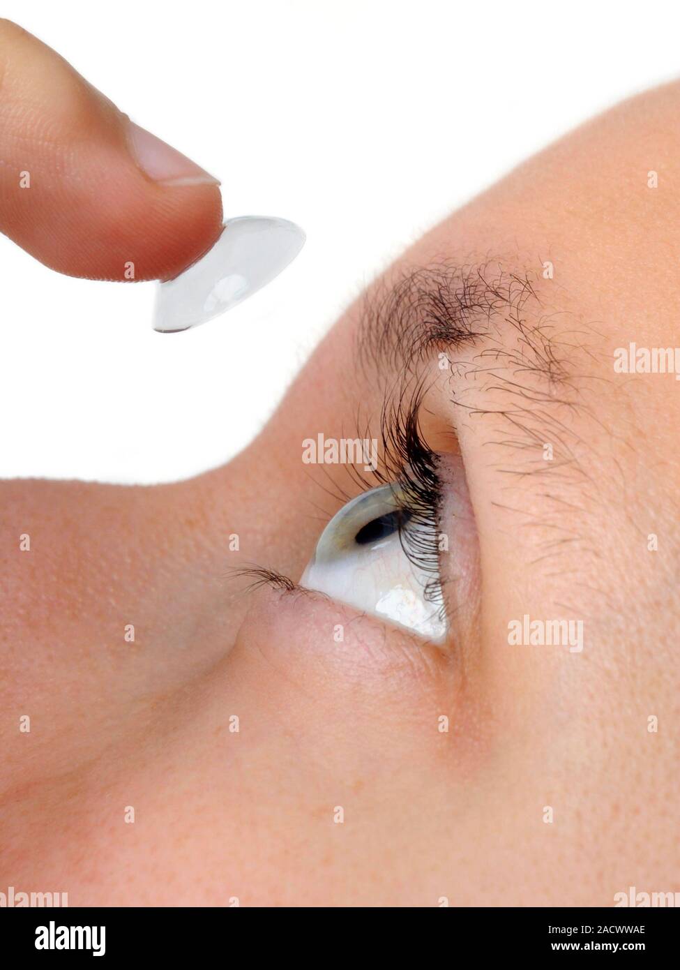 Contact lens. Close-up of a person placing a contact lens in an eye ...