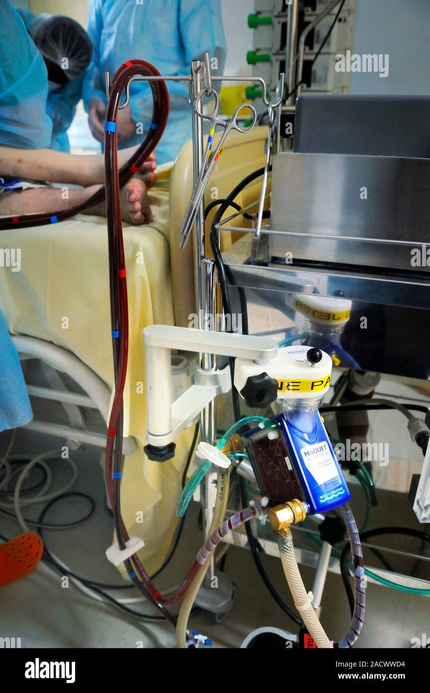 Toxicology hospital ward equipment. Tubes carrying blood from a patient ...