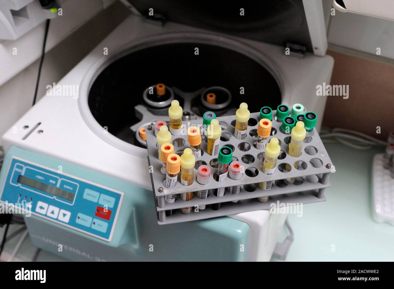 Toxicology analysis. Samples in a rack on top of an opened centrifuge ...