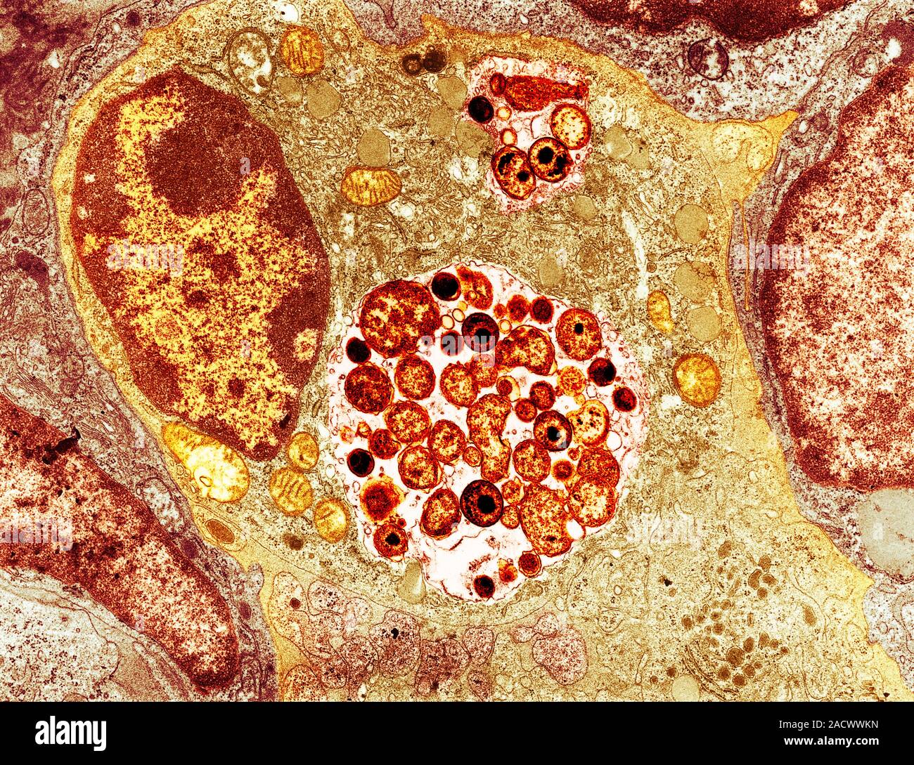 Chlamydia bacteria. Coloured transmission electron micrograph (TEM) of ...