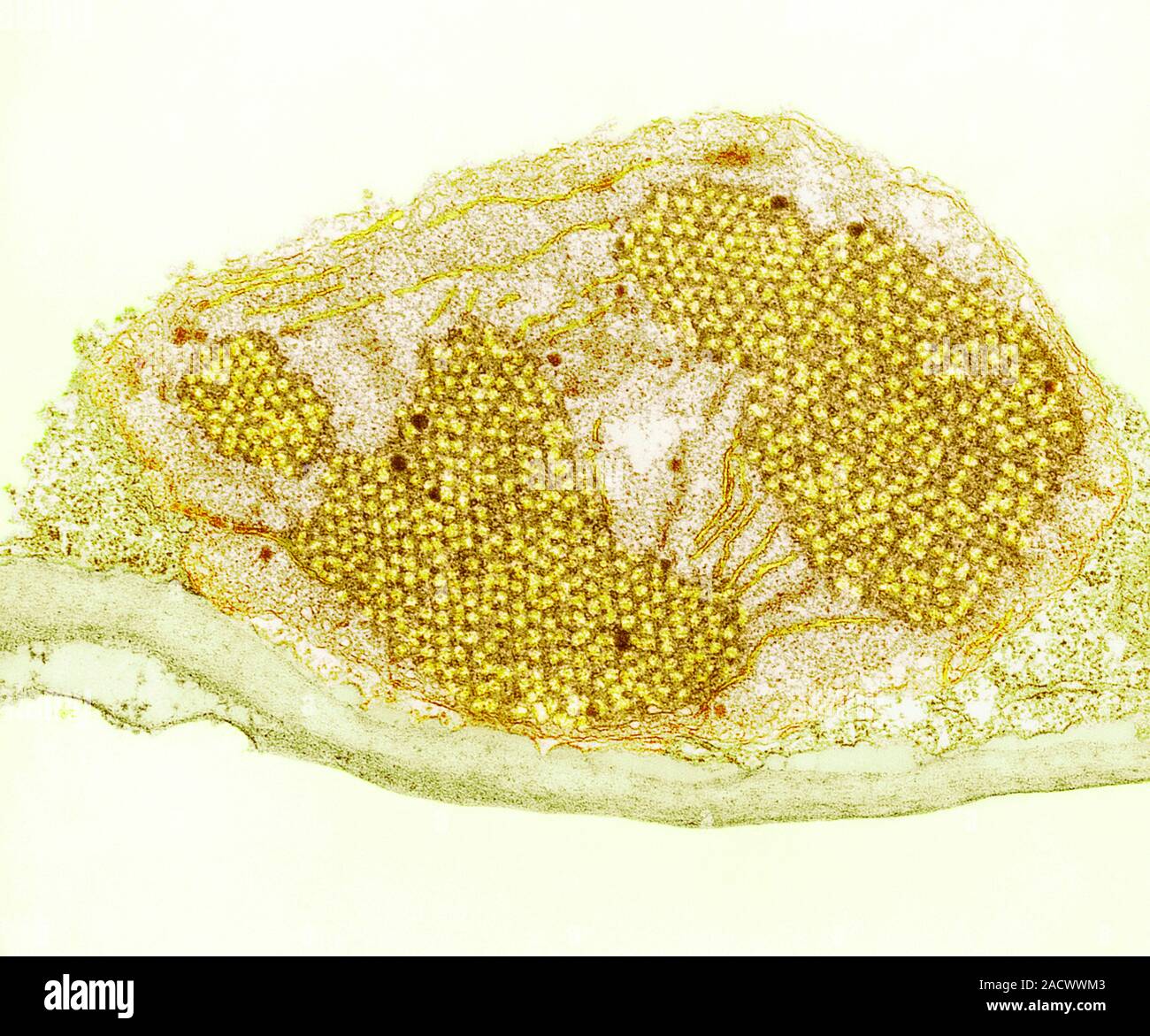 Etioplast. Coloured transmission electron micrograph (TEM) of a section ...