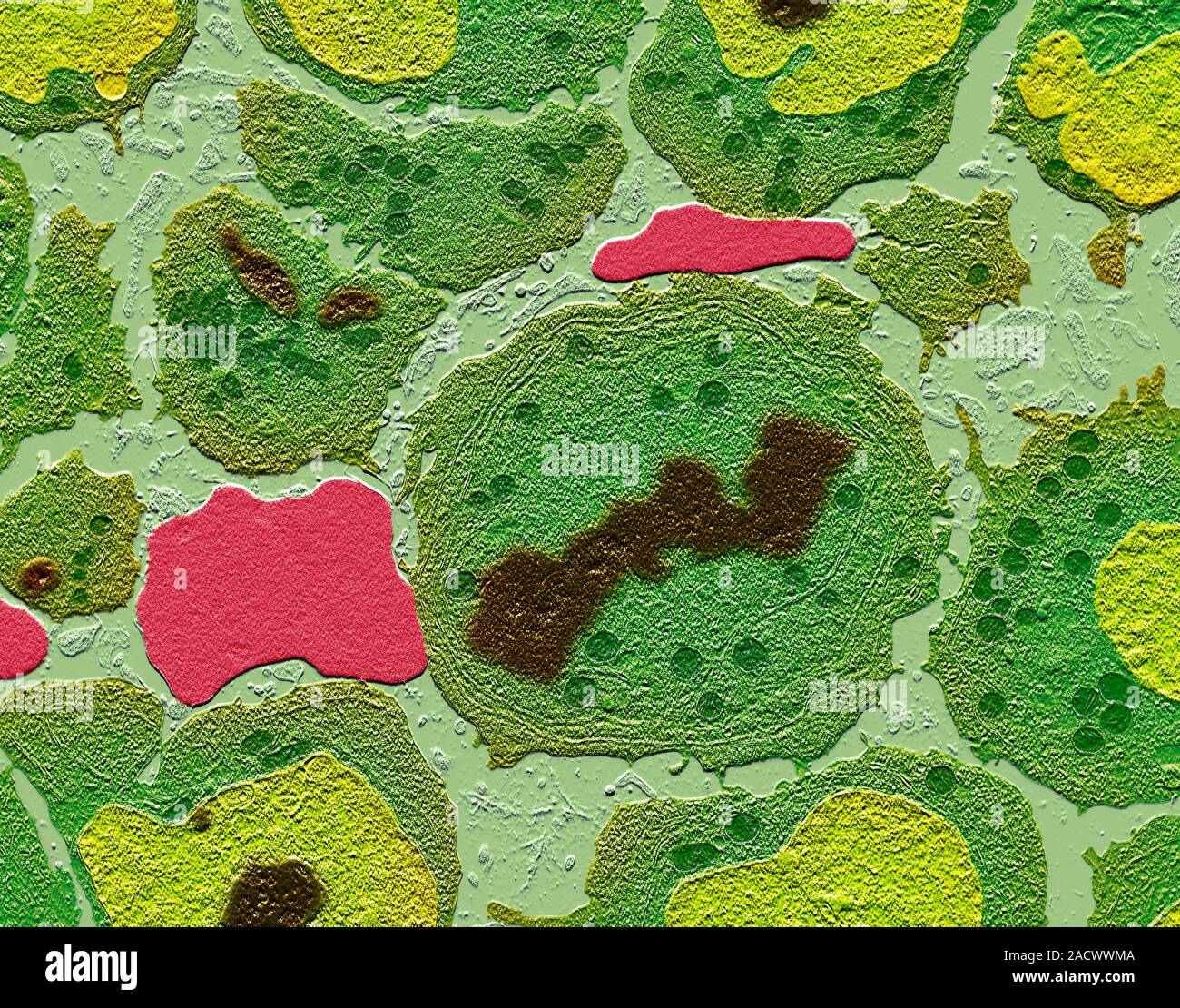 Plasma cell cancer. Coloured transmission electron micrograph (TEM) of ...