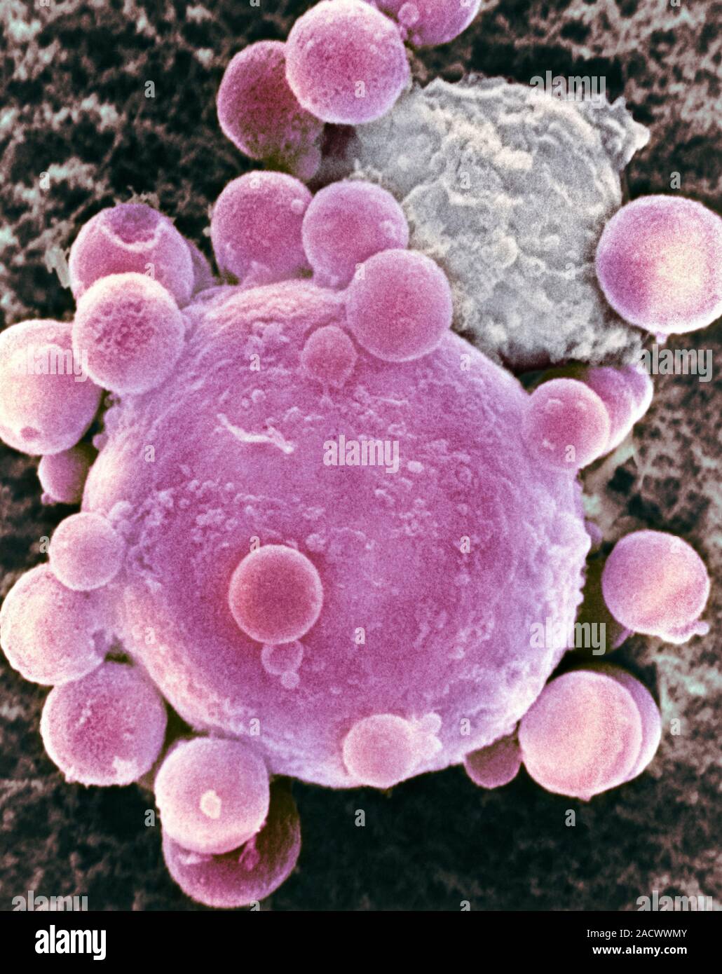 Lymphocyte attacking cancer cell. Coloured scanning electron micrograph ...