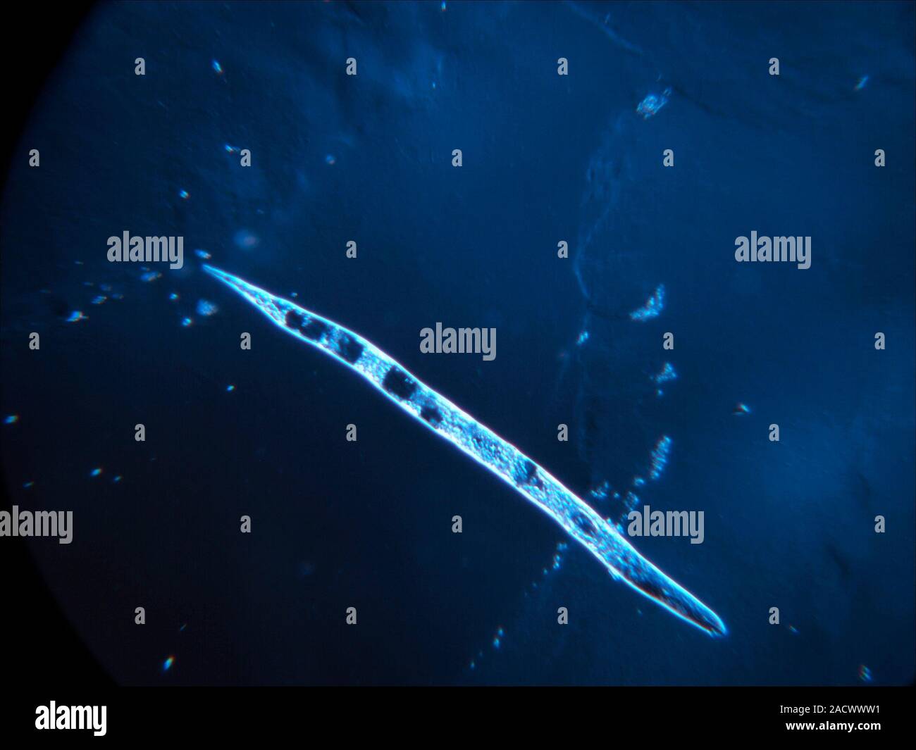 Meloidogyne nematode, light micrograph. Second-stage juvenile of the ...