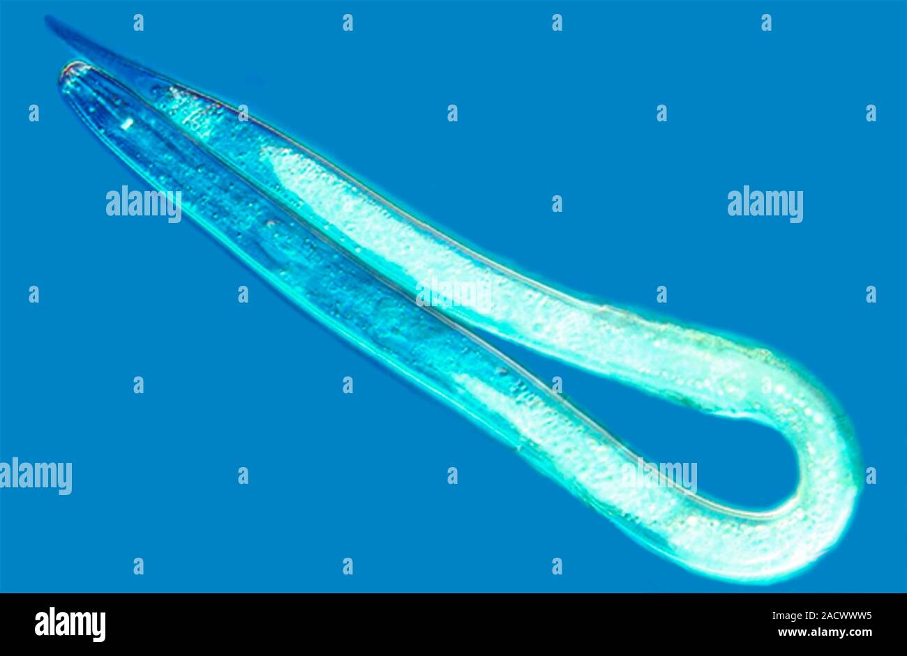 Globodera nematode, light micrograph. Juvenile golden nematode ...