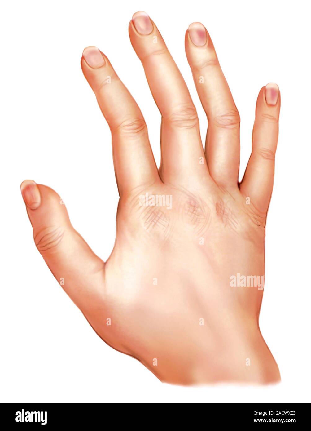 Illustration of the anatomical regions of the hand. This dorsal view is ...