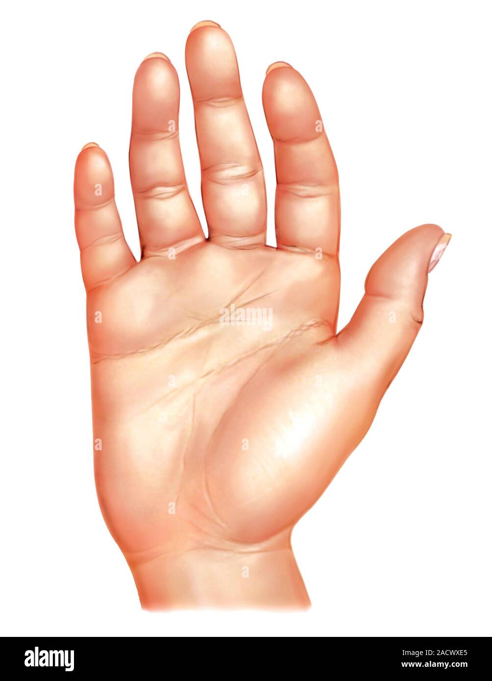 Illustration of the anatomical regions of the hand. This anterior view ...