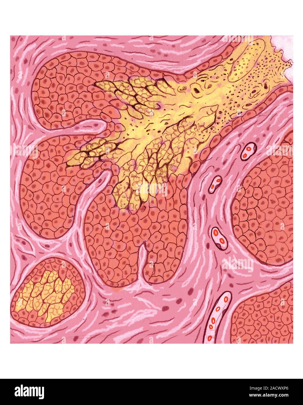 Illustration of the holocrine sebaceous glands. This illustration is ...