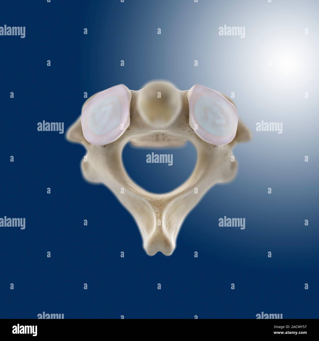 Axis vertebra (C2), artwork. This is the second vertebra in the spine ...
