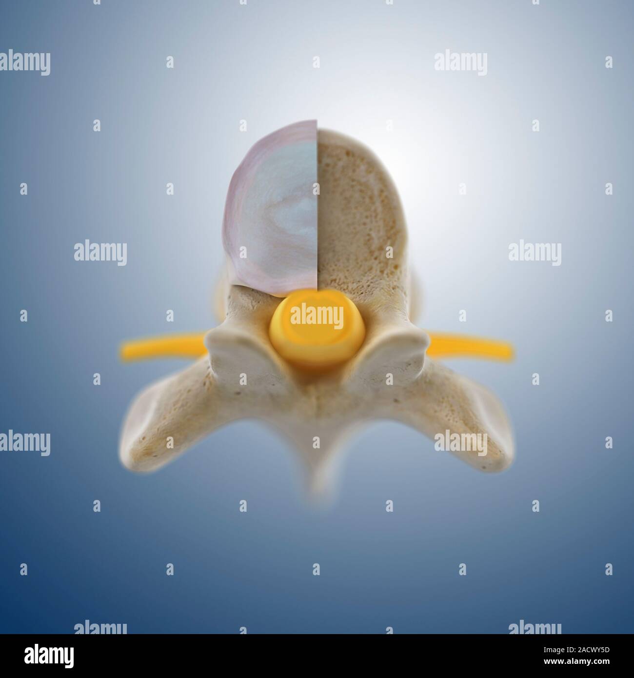Thoracic vertebra (T6), artwork. This is the vertebra's upper (superior ...