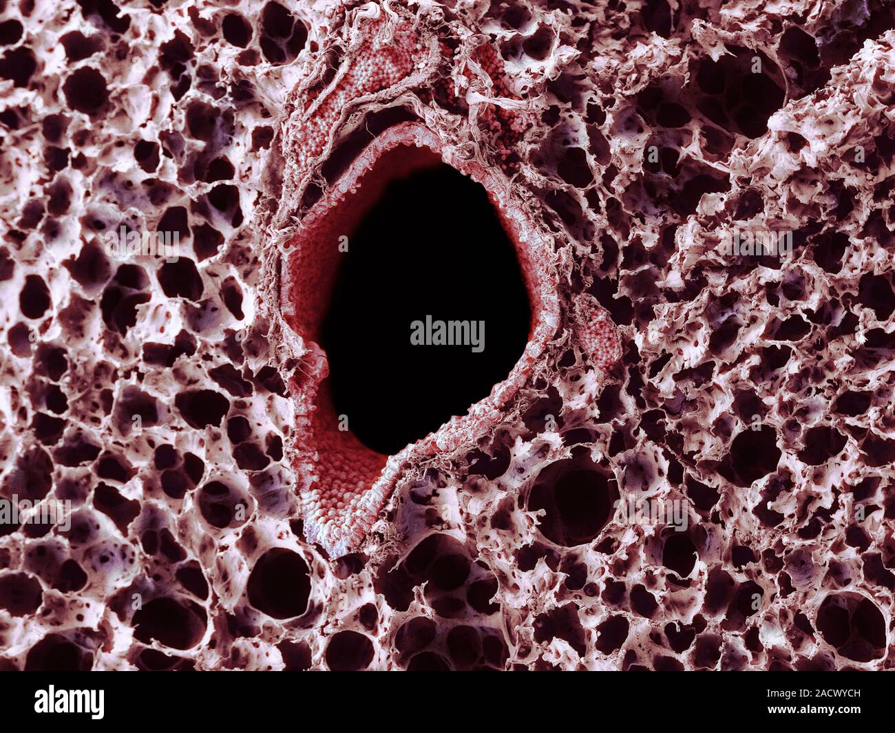 Lung tissue, coloured scanning electron micrograph (SEM). Visible ...