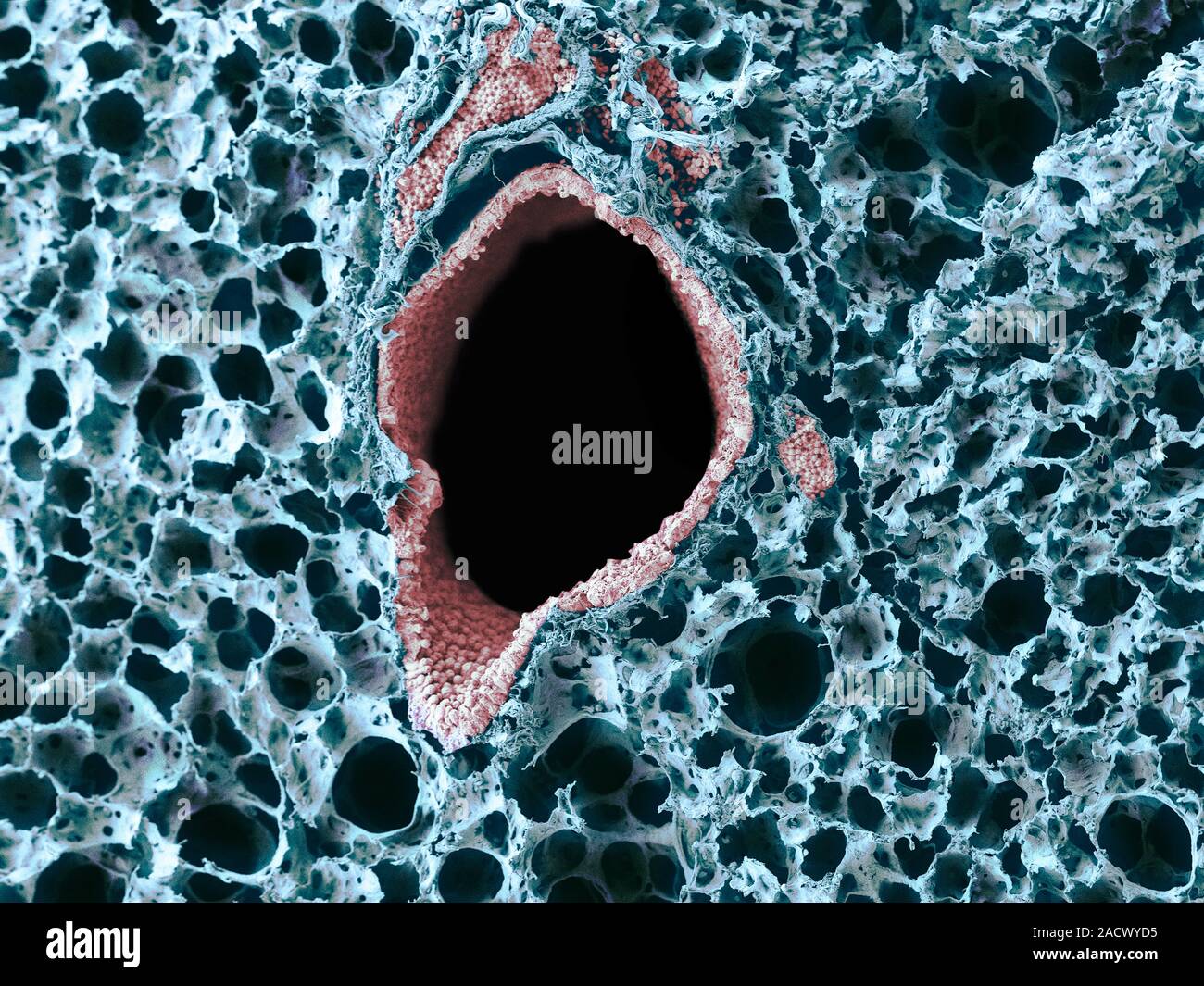 Lung tissue, coloured scanning electron micrograph (SEM). Visible ...