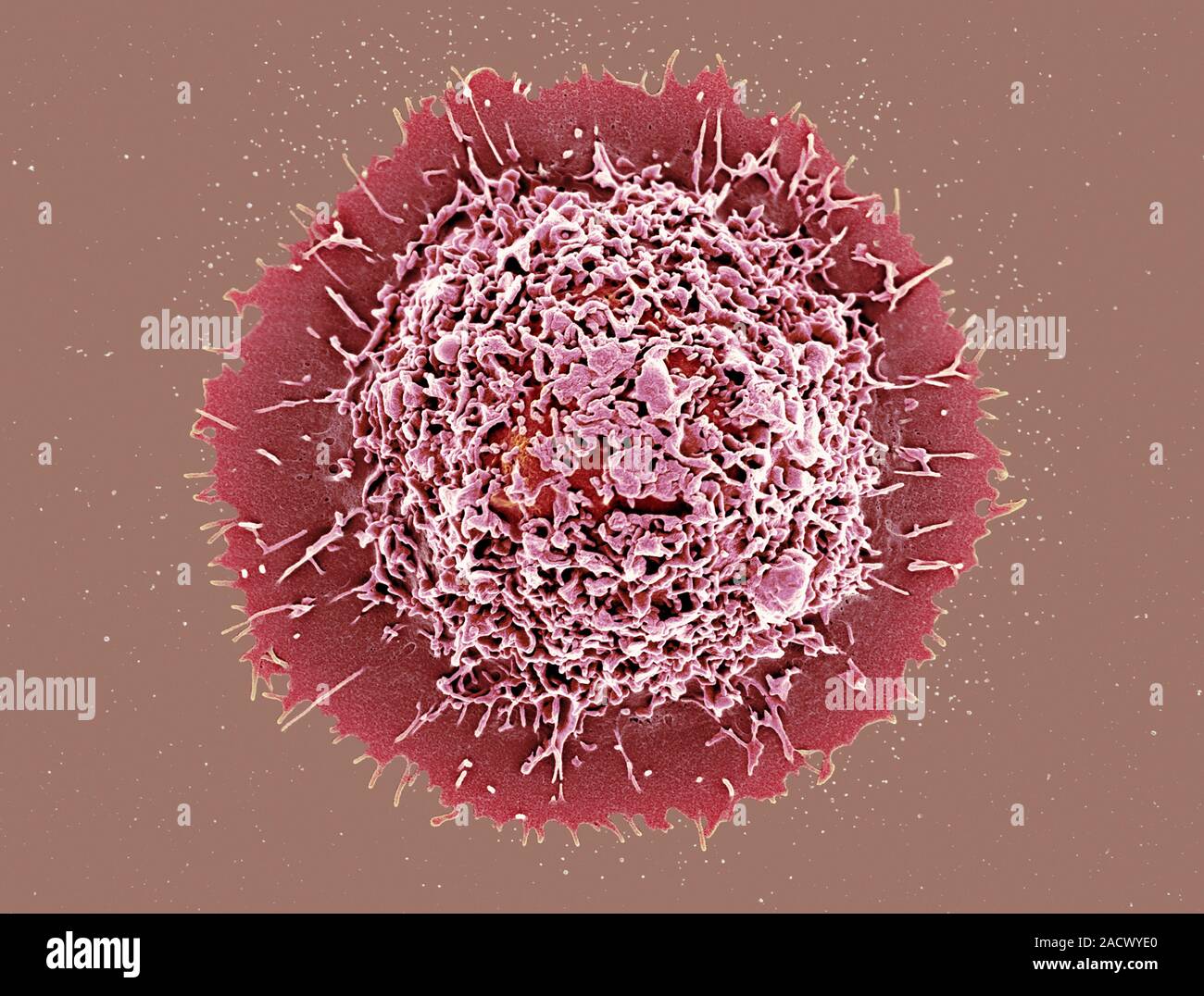 Alveolar macrophage. Coloured scanning electron micrograph (SEM) of an ...