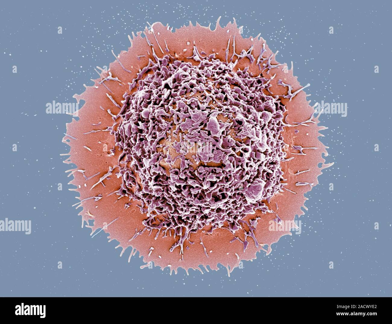 Alveolar macrophage. Coloured scanning electron micrograph (SEM) of an alveolar macrophage white ...