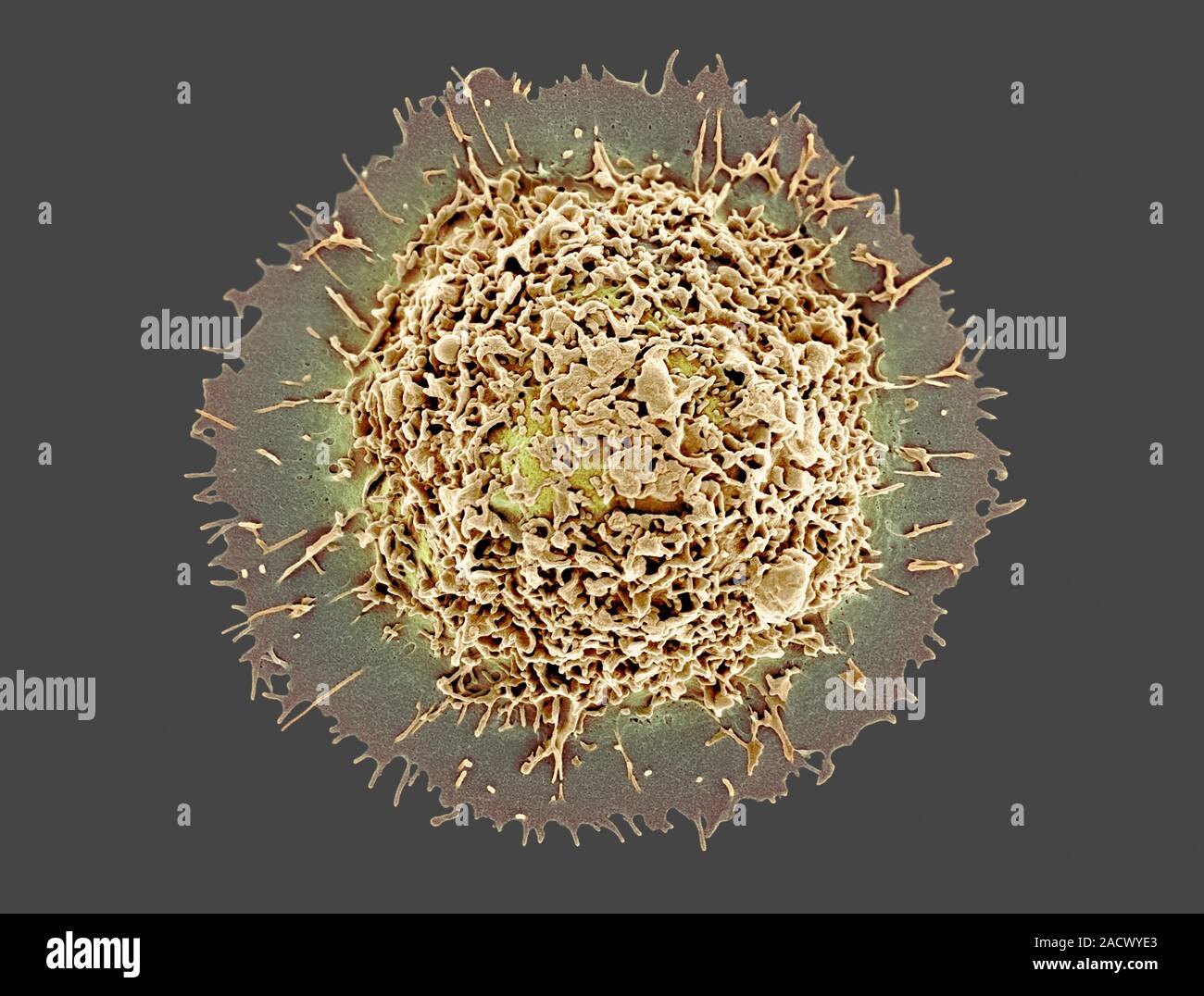 Alveolar macrophage. Coloured scanning electron micrograph (SEM) of an alveolar macrophage white ...