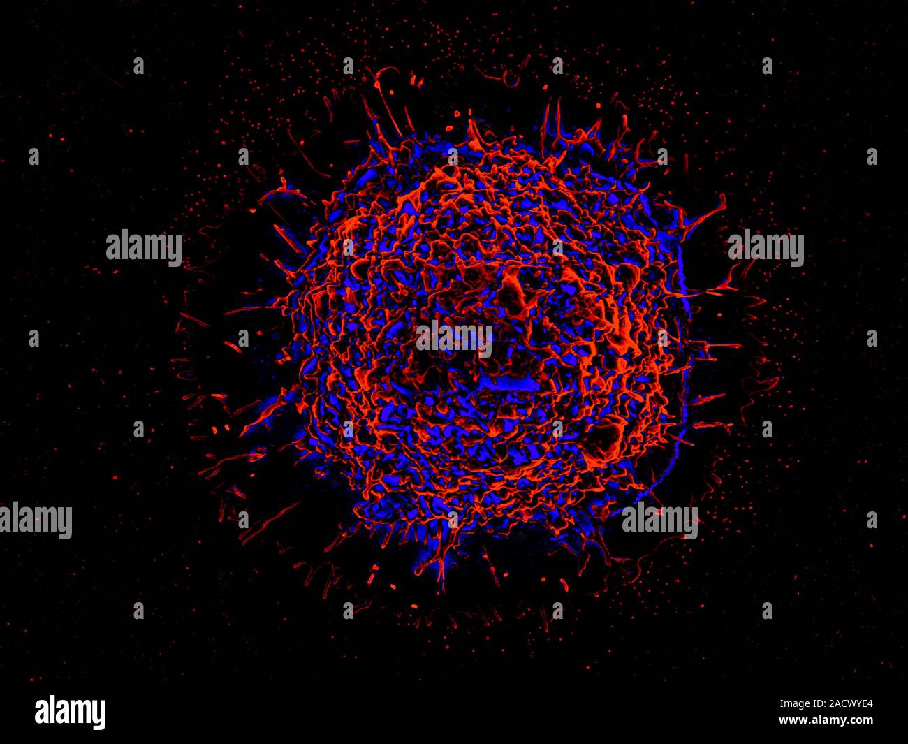 Alveolar macrophage. Coloured scanning electron micrograph (SEM) of an alveolar macrophage white ...