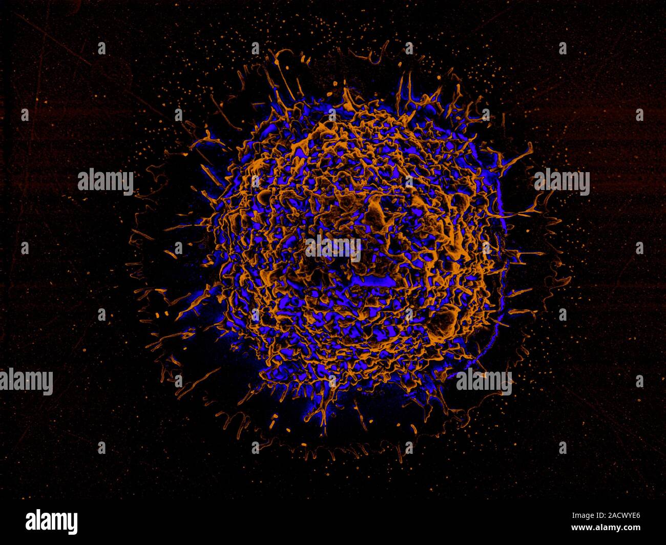 Alveolar macrophage. Coloured scanning electron micrograph (SEM) of an ...