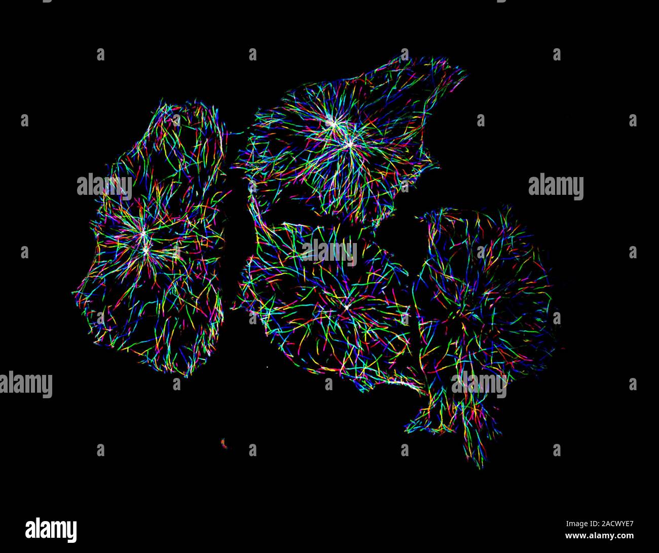 HeLa cells. Confocal light micrograph of HeLa cells. HeLa cells are a ...