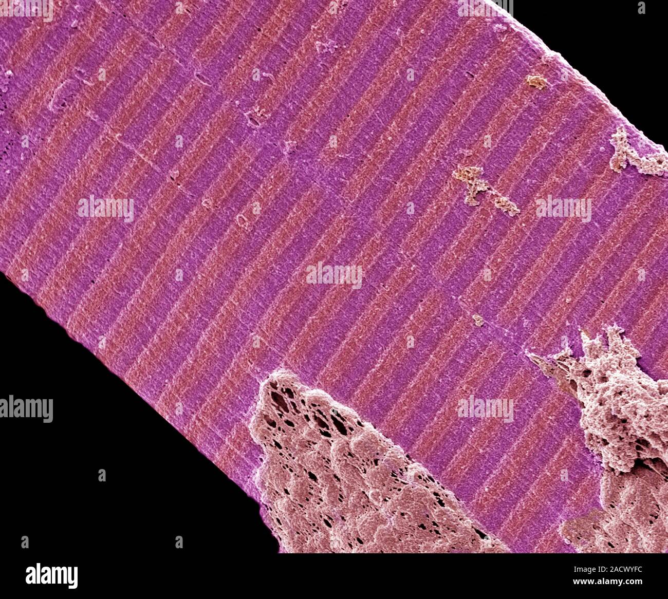 Muscle fibre, scanning electron micrograph (SEM). Muscle fibres consist ...