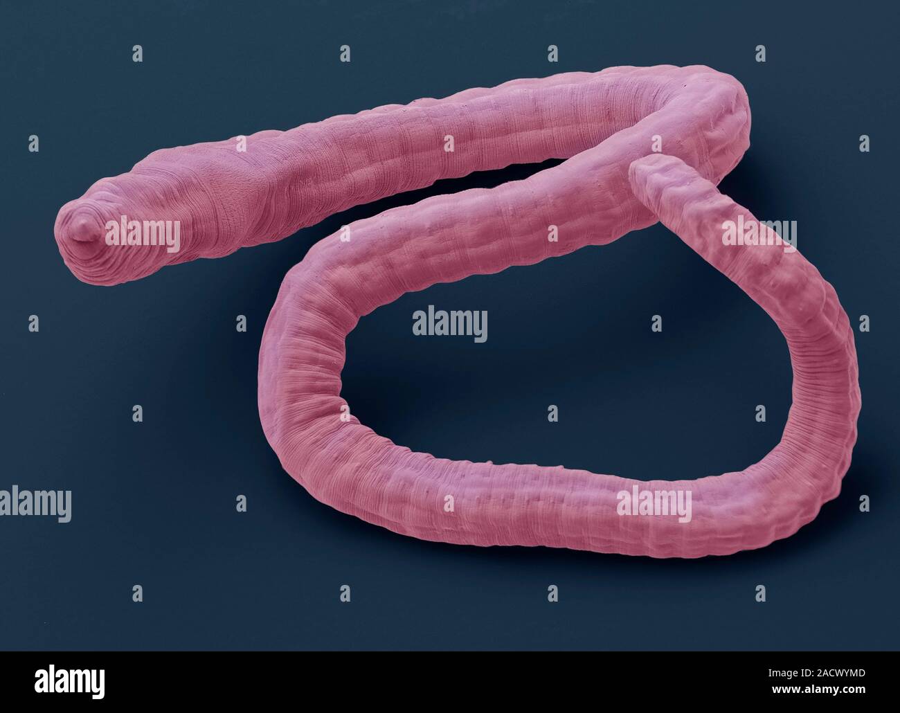Tubifex worm, coloured scanning electron micrograph (SEM). Tubifex ...