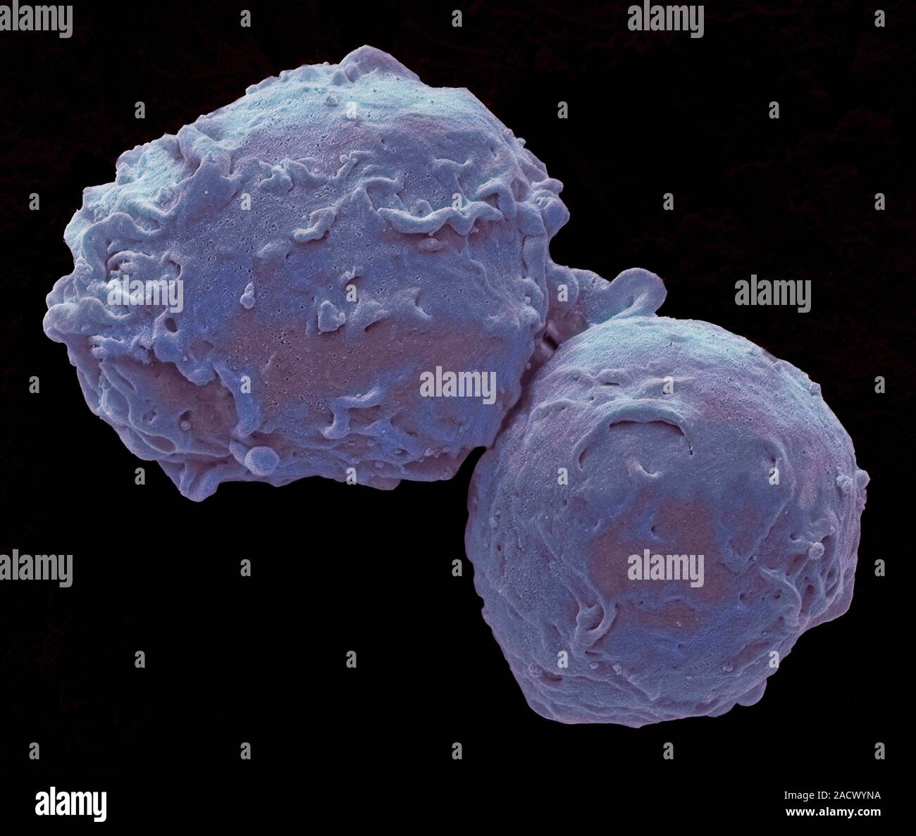 Human monocytes. Coloured scanning electron micrograph (SEM). Monocytes ...