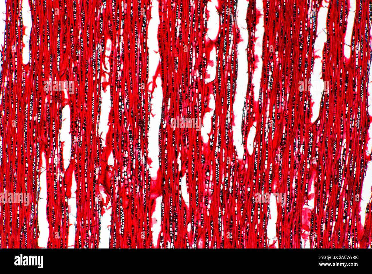 Palaquium obovatum stem. Light micrograph of a tangential longitudinal ...