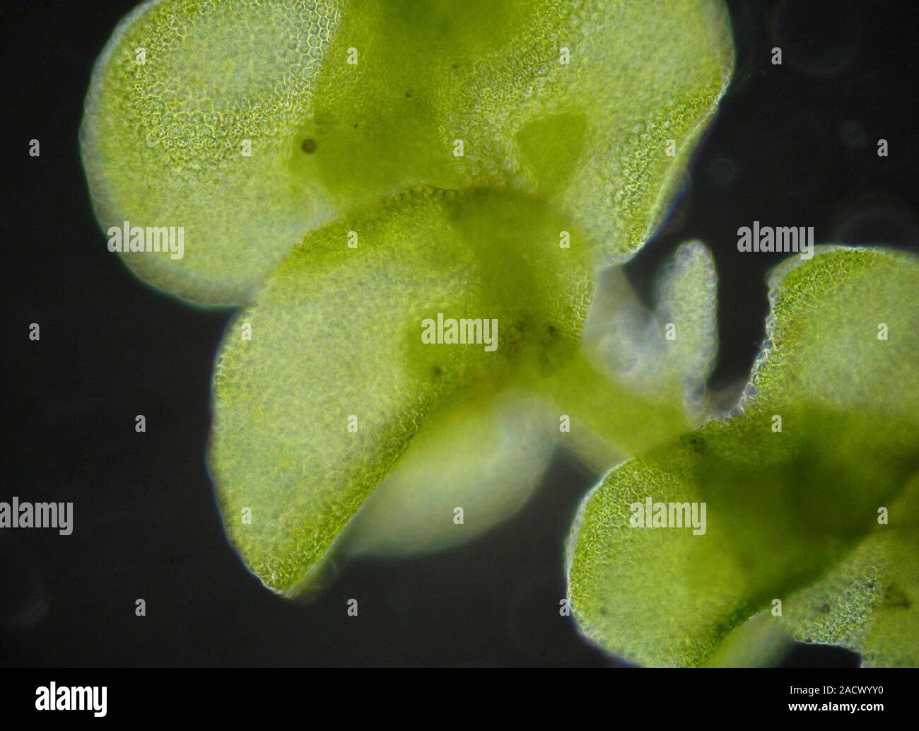 Moss, light micrograph. Magnification: x35 when printed at 10 ...