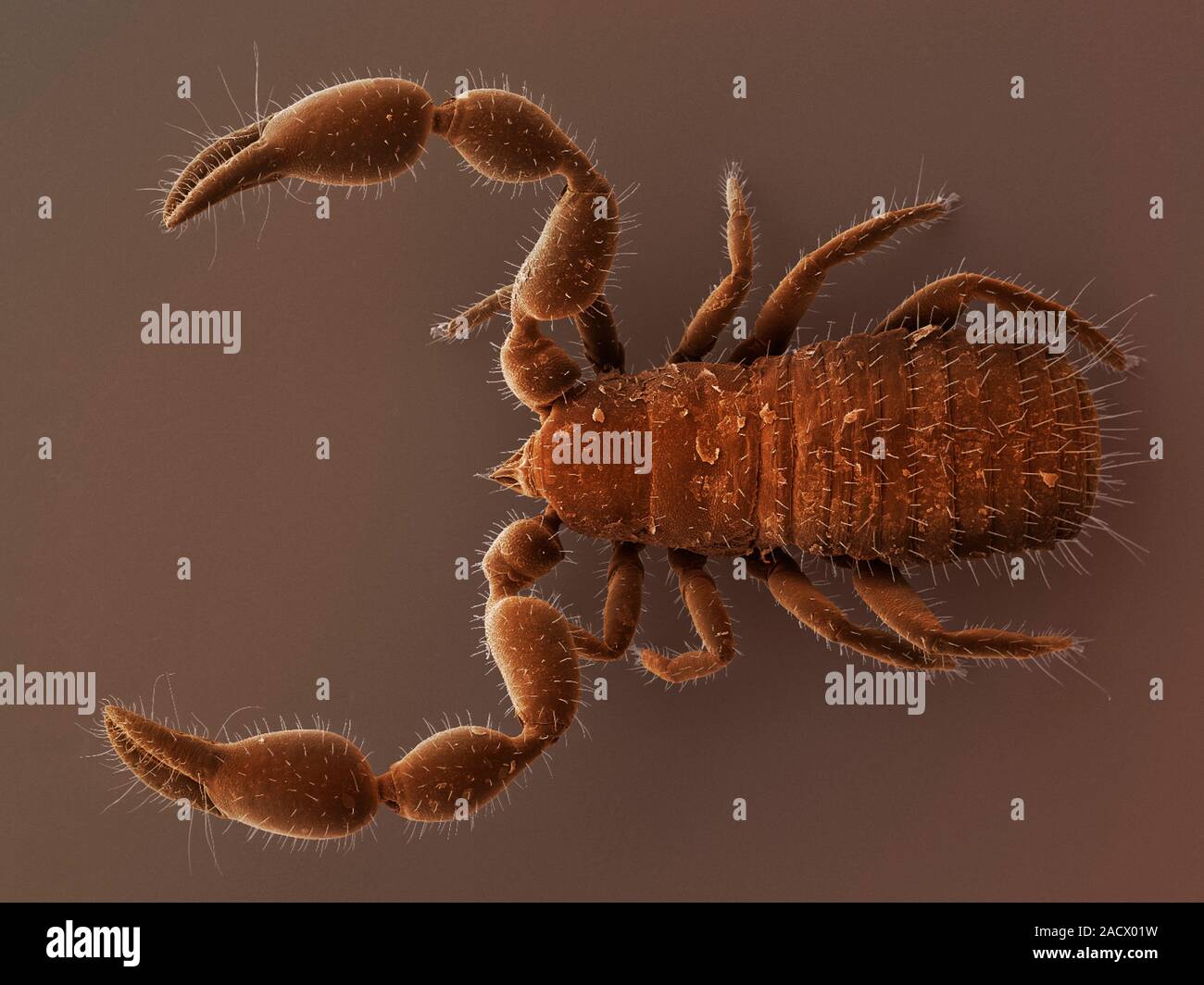 Scanning electron micrograph (SEM) of a Pseudoscorpion (Lamprochernes ...