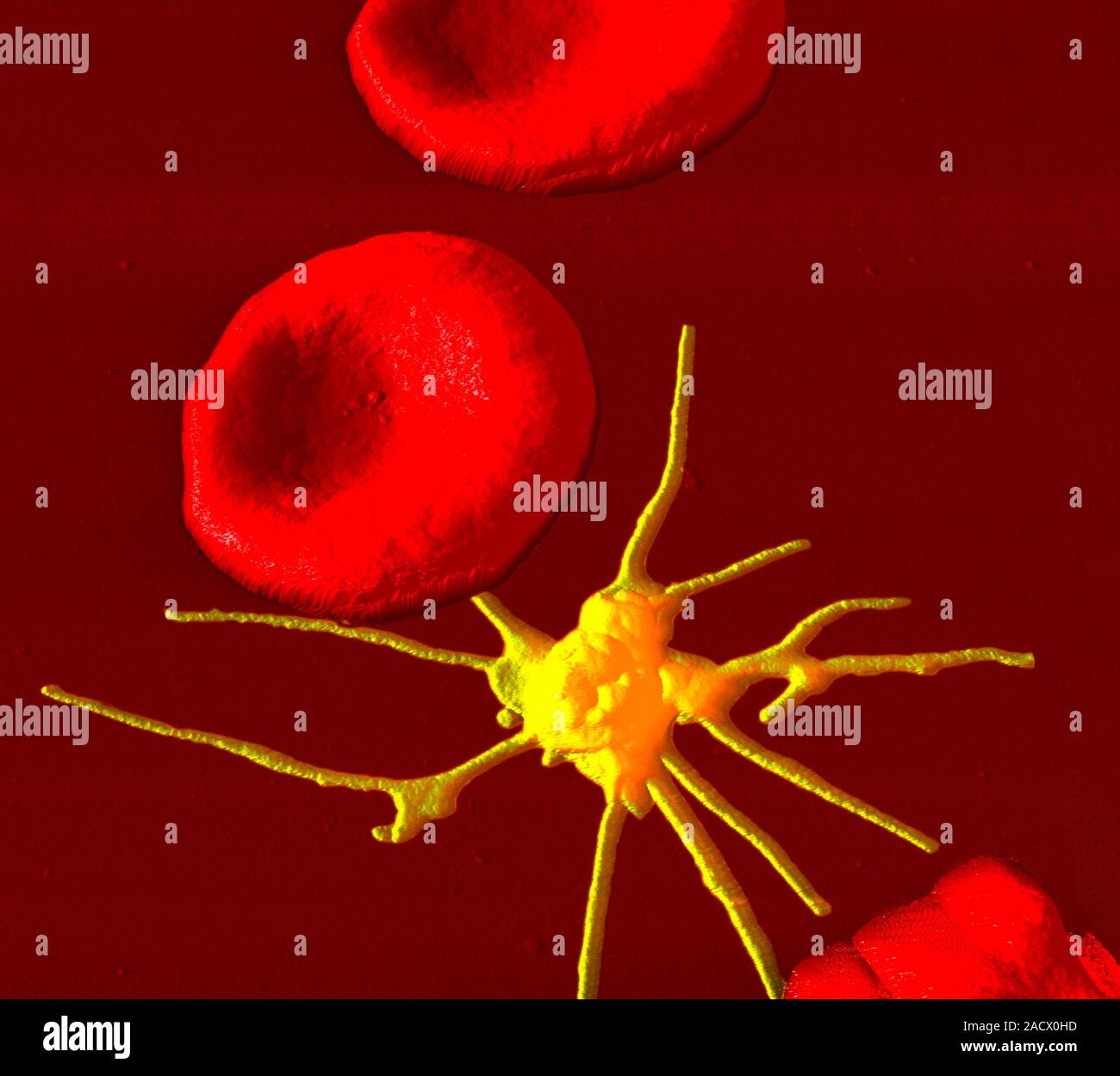 Coloured atomic force micrograph (AFM) of an activated platelet (yellow ...