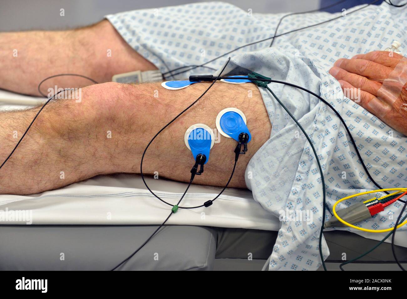Electrocardiogram (ECG) electrodes placed on a patient's leg. The ...